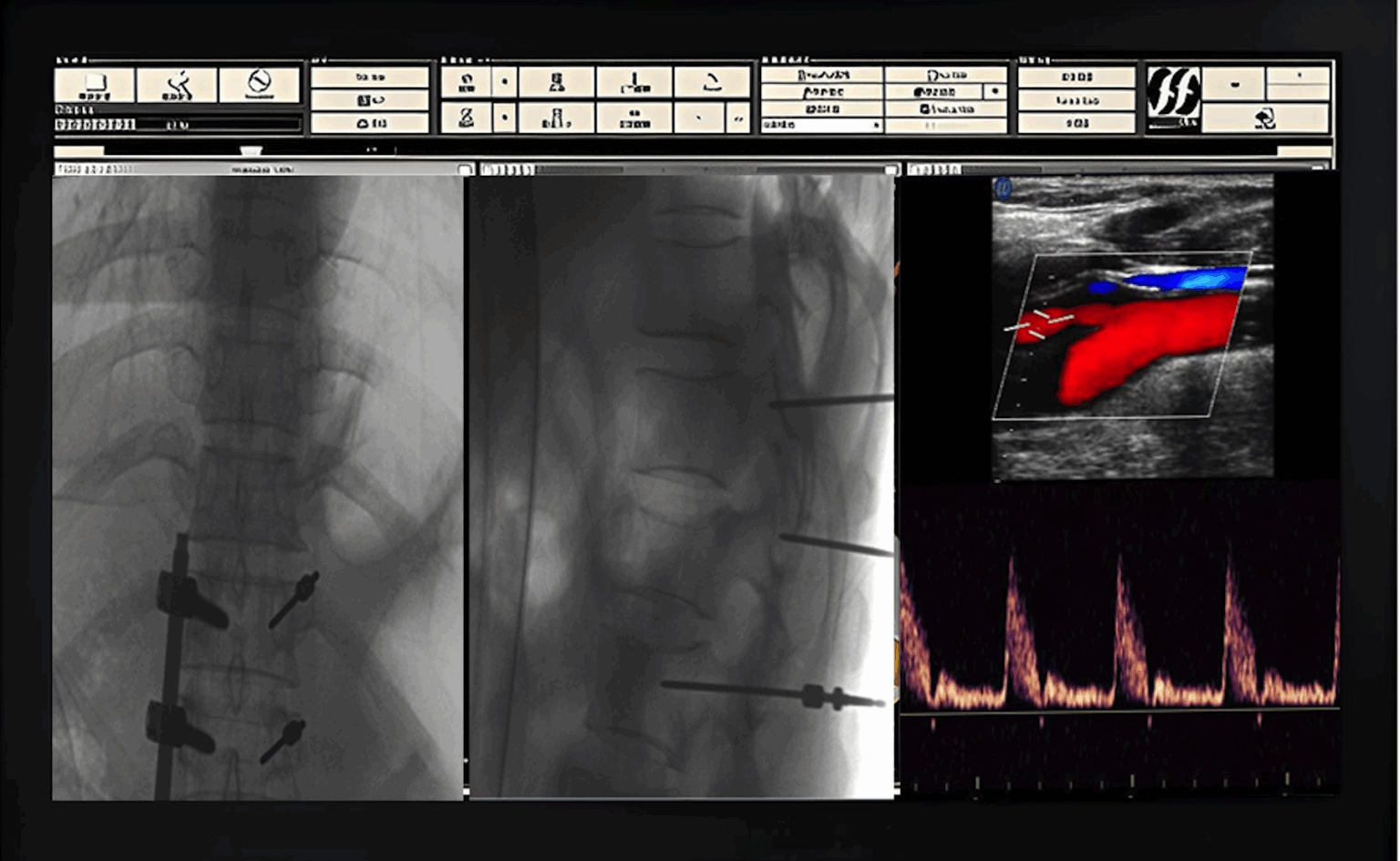 G-Arm DeepBlue - Whale Imaging
